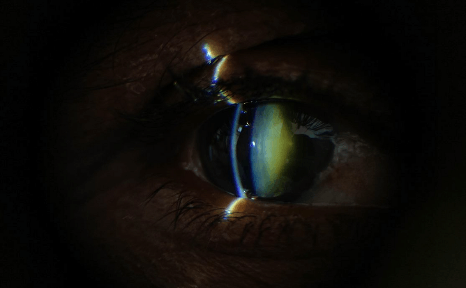 Remidio PSL D20 | Hand Held Portable Slit Lamp